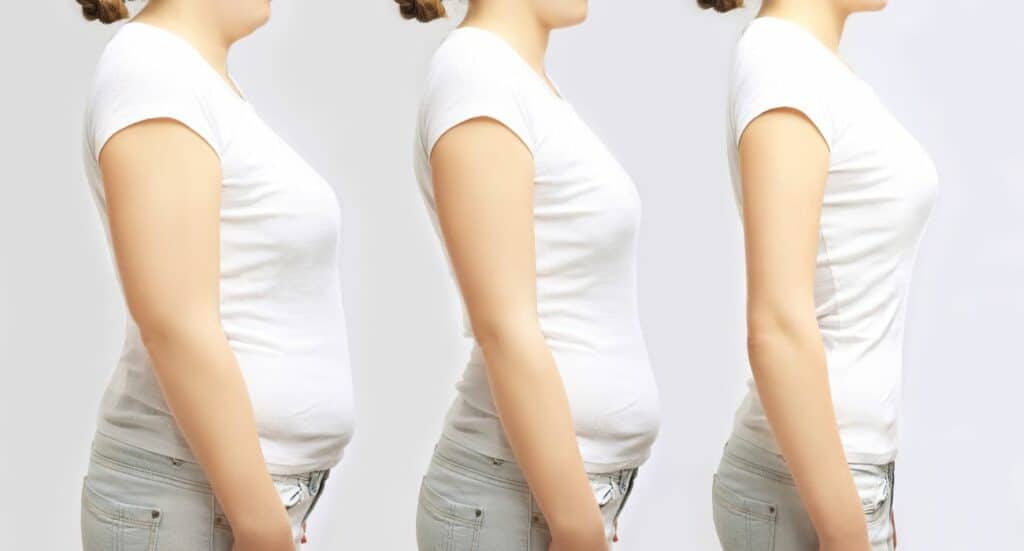 5 Benefits Of Non-Invasive Fat Reduction | Pandit Clinic